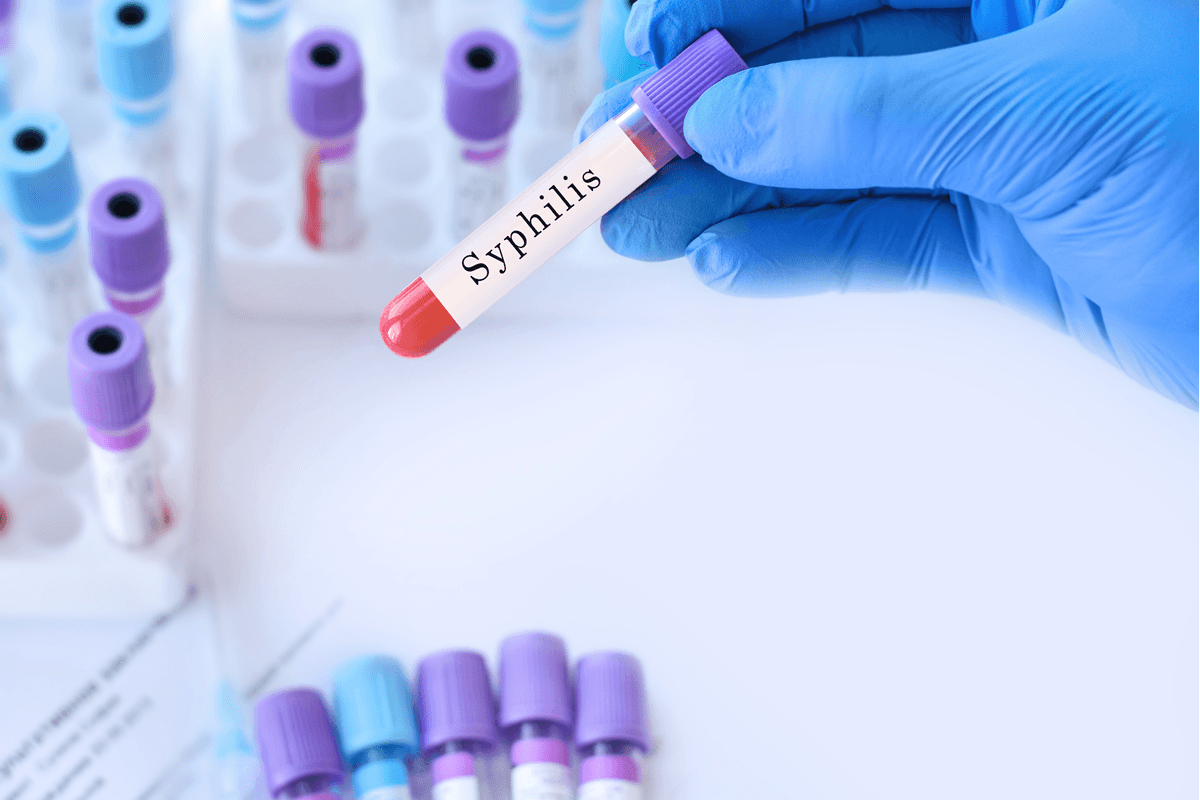 STI that can show no symptoms hits record high