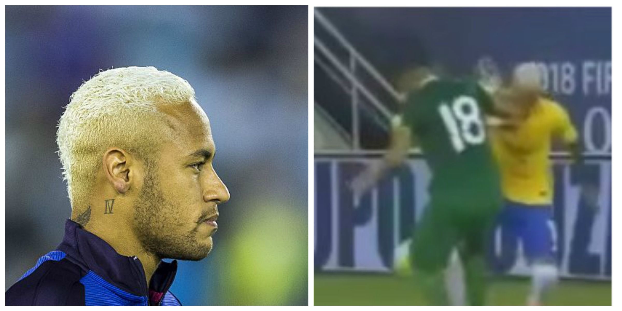 Neymar left with bloodied face after clash in Brazil's game with ...