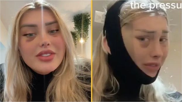 Woman leaves people horrified after explaining how the back of her head ...