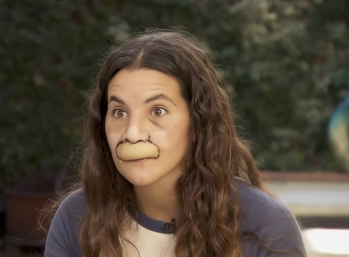 Model whose lip was bitten off by dog shows off transformation after ...