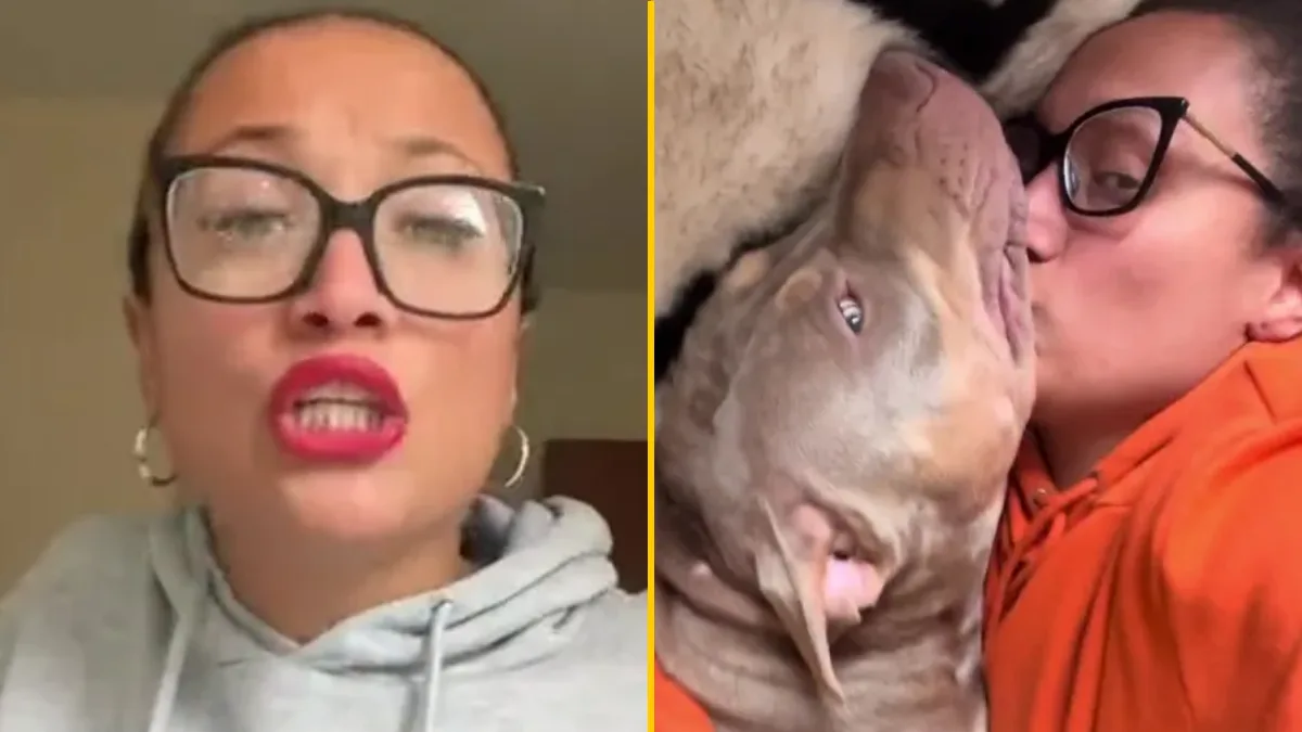 Model whose lip was bitten off by dog shows off transformation after ...