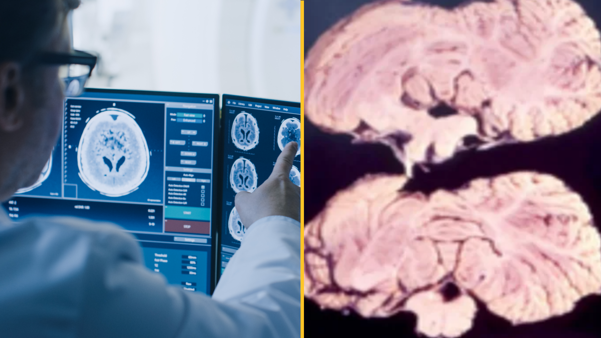 World's most deadly disease has fatality rate of almost 100%