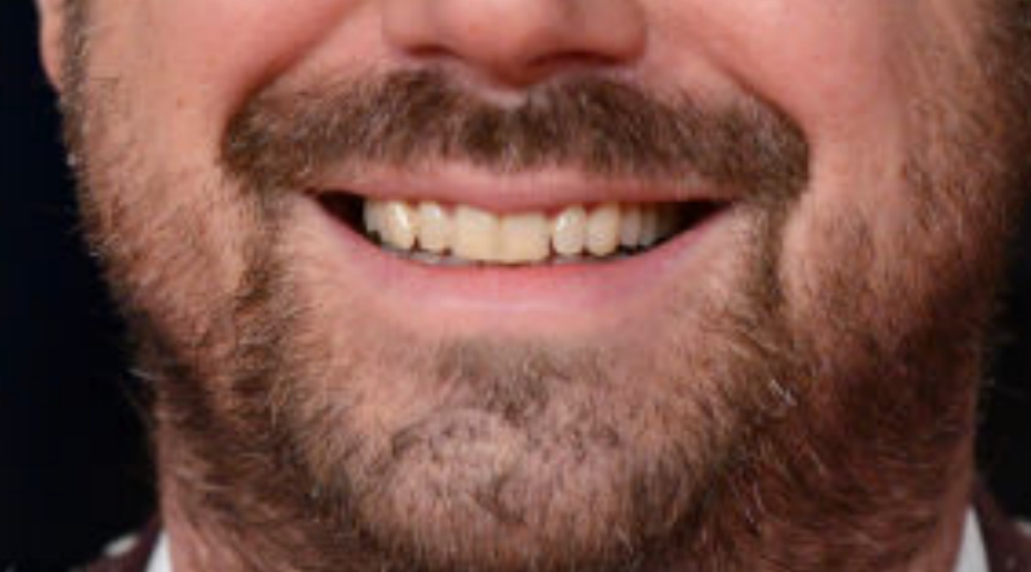 The JOE Friday Pub Quiz: week 395