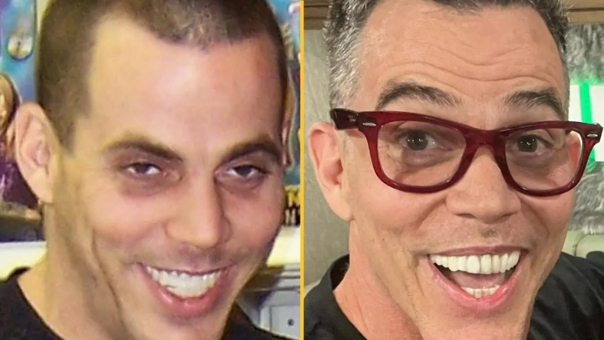 Steve-O shares incredible before-and-after pics to mark sobriety ...