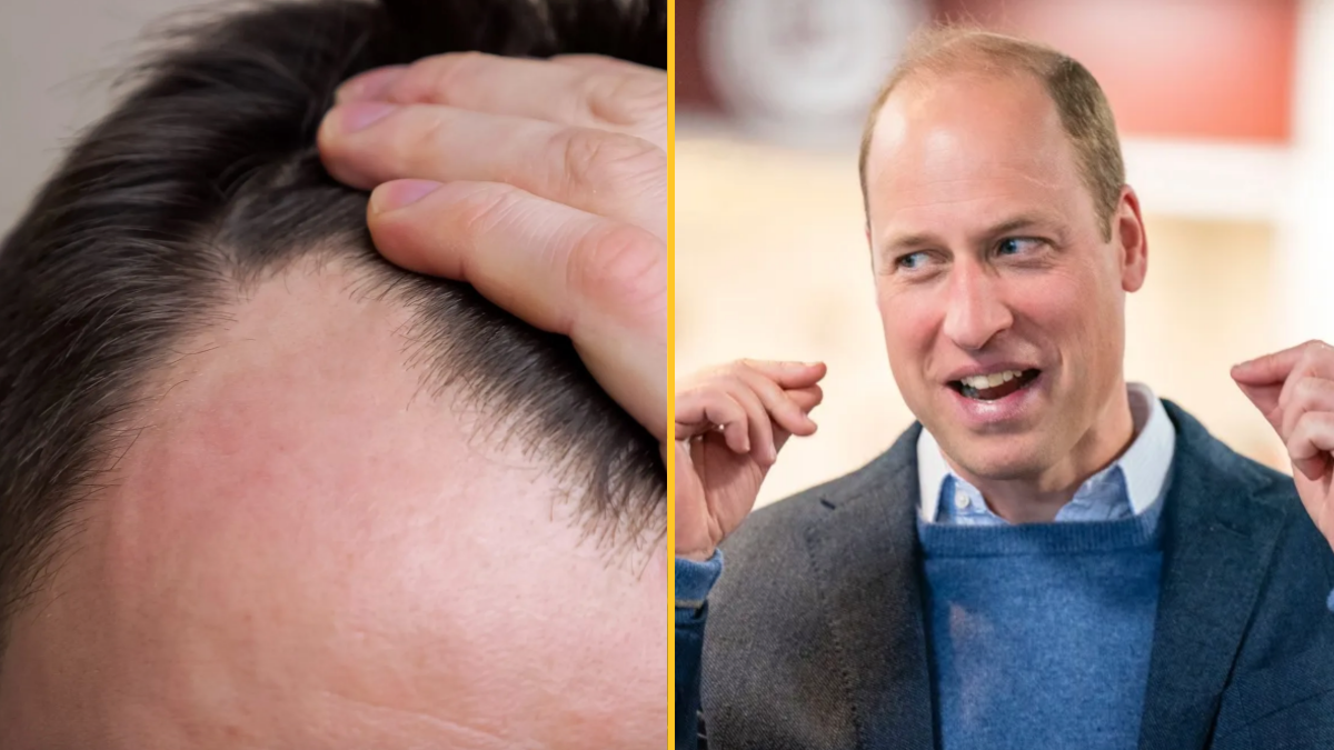 Scientists may have discovered potential cure for baldness - JOE.co.uk