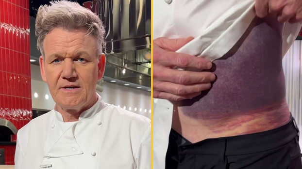 Gordon Ramsay says he's 'lucky to be alive' after serious accident ...