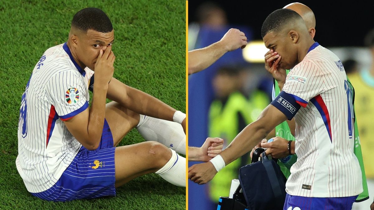Update given on Kylian Mbappé's EURO 2024 hopes following nose injury