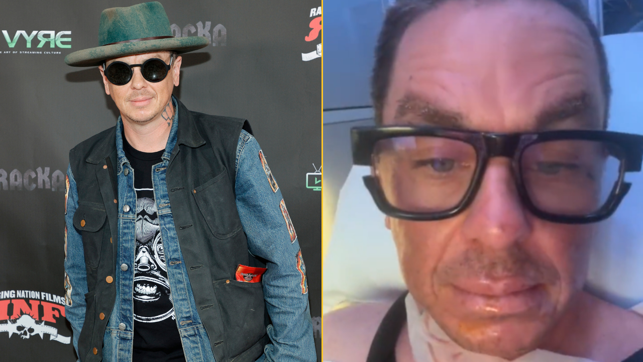 Slipknot star in hospital with 'serious burns' after 'setting himself ...