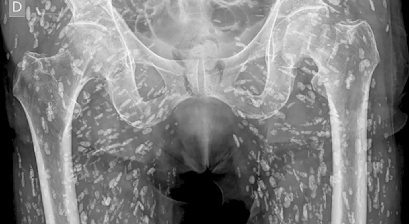 Chunkz weight loss transformation: YouTube star reveals diet secrets