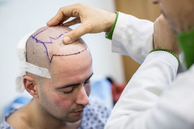 Man, 24, who underwent world's first face and double hand transplant ...