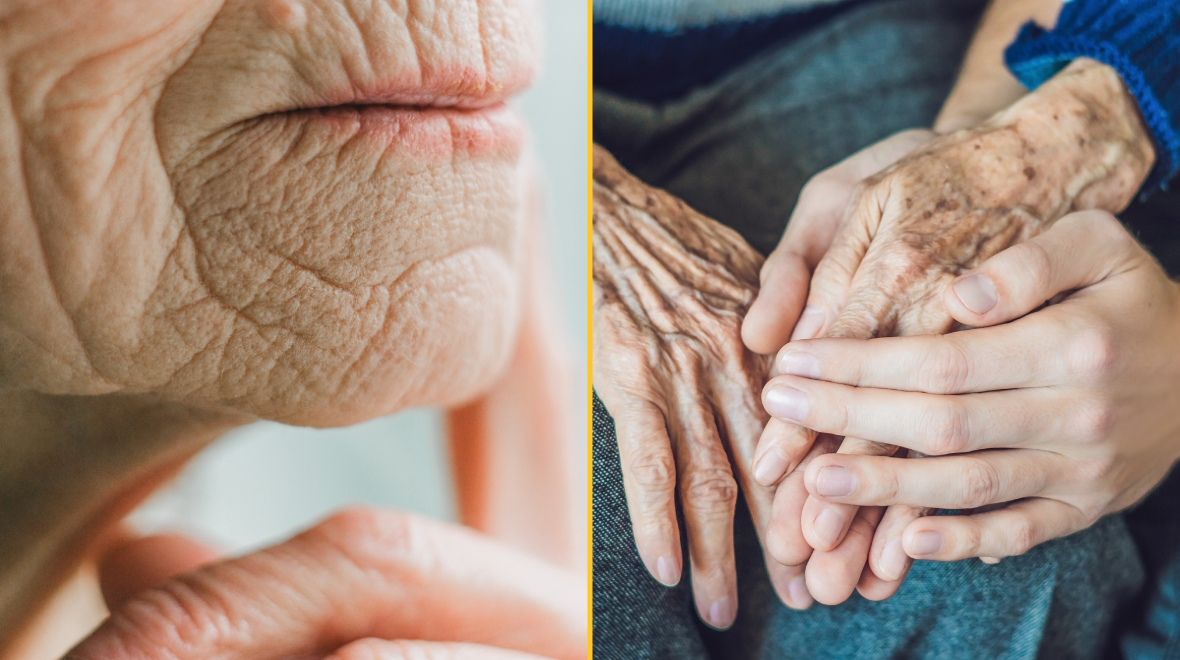 Drug-resistant fungus that attacks bum and groin is spreading rapidly ...